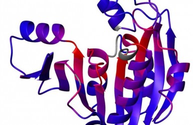 Enfermedad de almacenamiento de glucógeno por déficit de aldolasa A ...