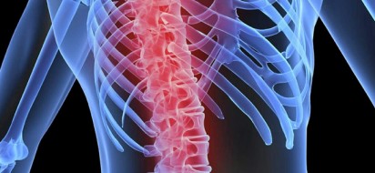 Mielitis transversa aguda | FEMEXER