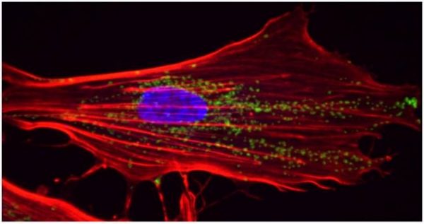 Anoftalmia/microftalmia – atresia esofágica | FEMEXER