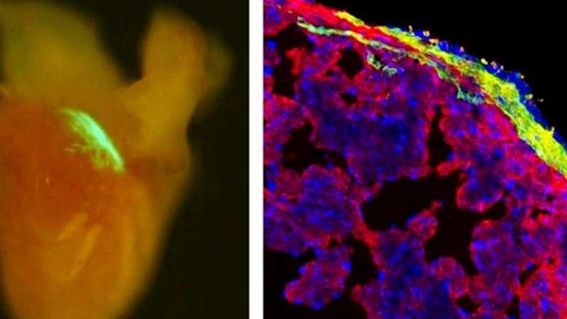 Celulas del corazón | FEMEXER