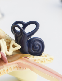 Sordera progresiva con fijación del estribo | FEMEXER